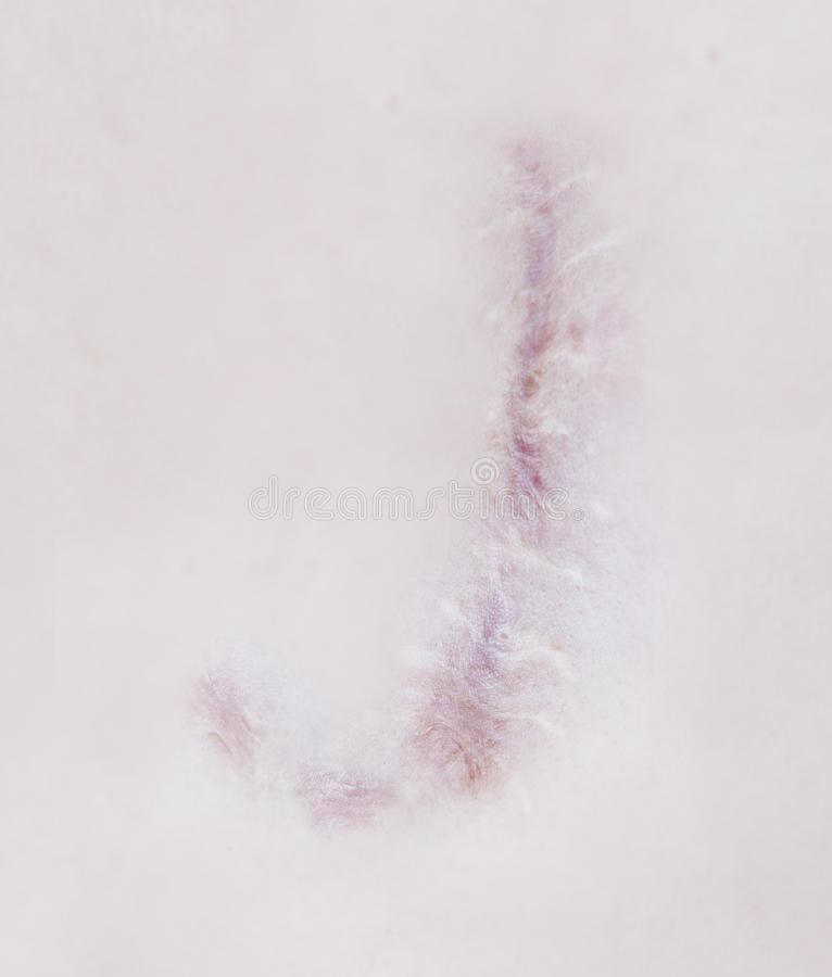 Scars – Arnel Aquino, SJ – One Lost Sheep